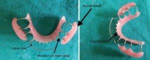 Stop Cheek Biting: Crush Your Habit With A Mouth Guard - Vast Diversity