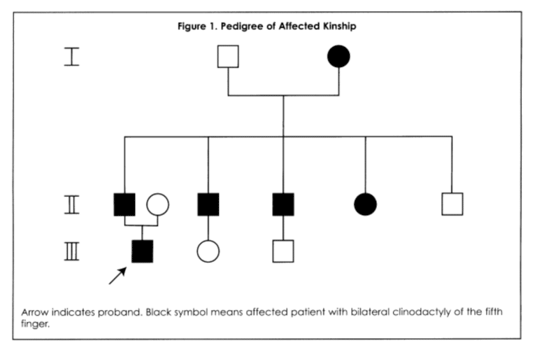 Bent Little Finger: A Secret Sign of ADHD or Autism? - Vast Diversity